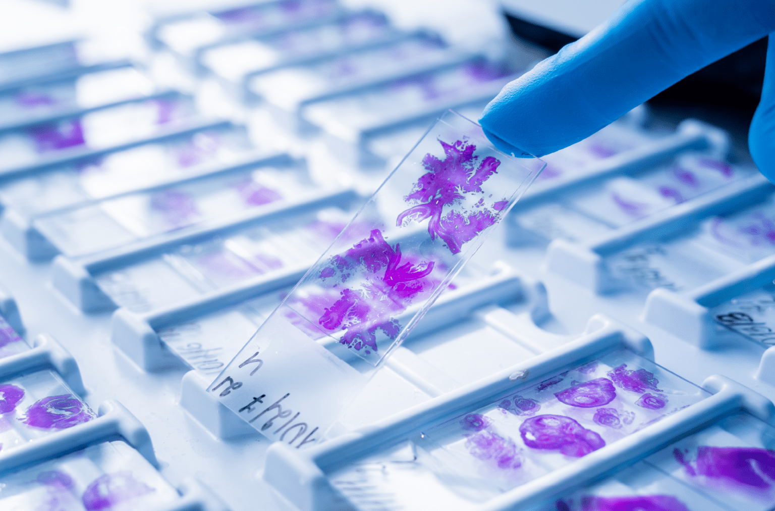 What Is Formalin Fixed Paraffin Embedded Ffpe Tissue Biomodal